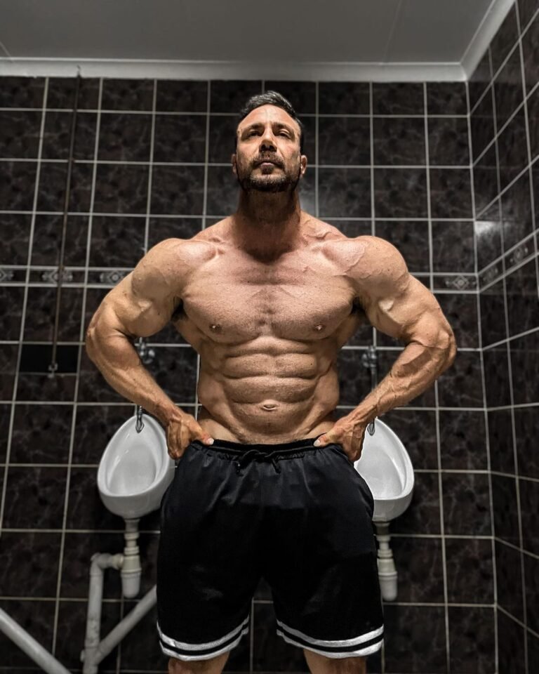 Noel Deyzel’s Inspiring Journey: Overcoming Adversity and Spreading ...