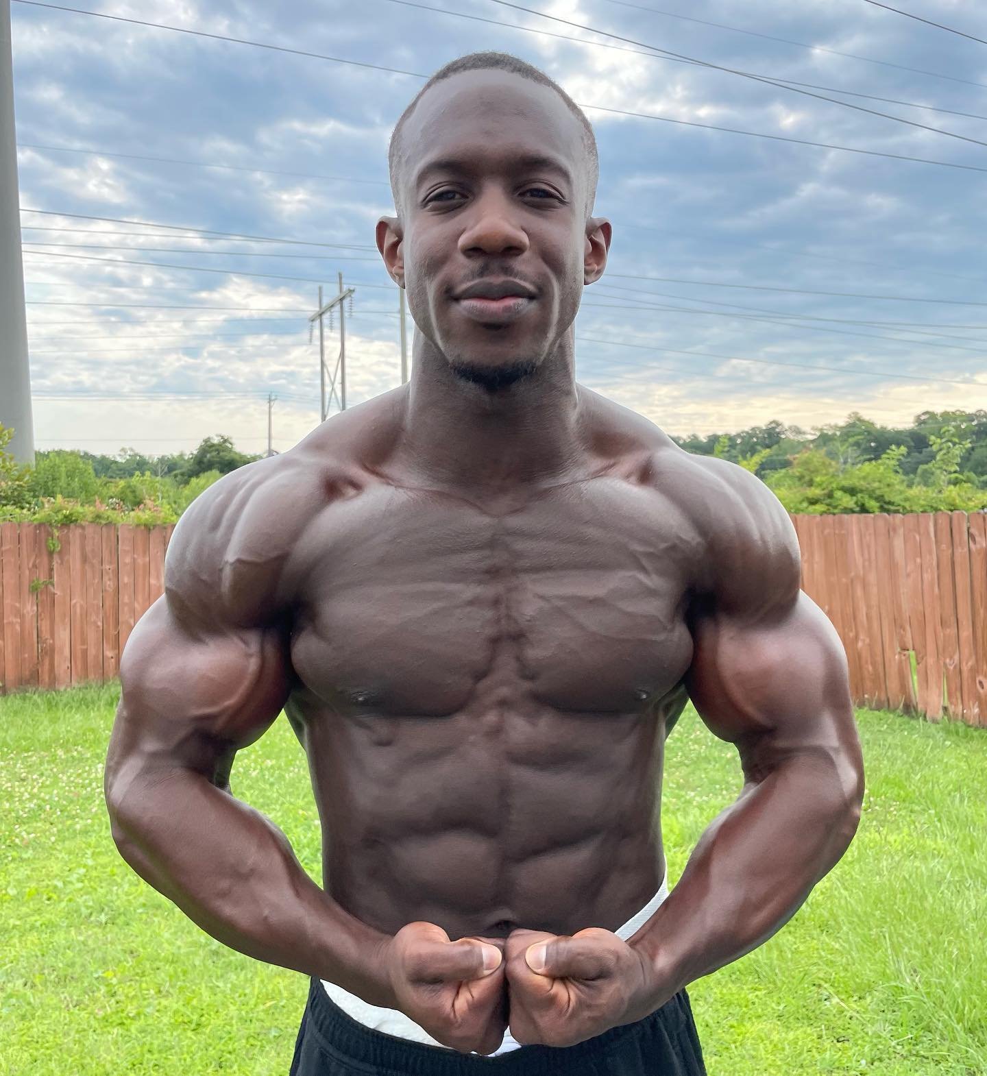 35 Years Old Bodybuilder, Hospitalized with Heart Failure After Cold ...